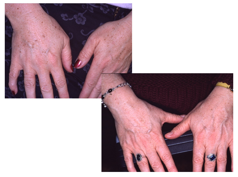 Les Lasers Médicaux - SFPMed